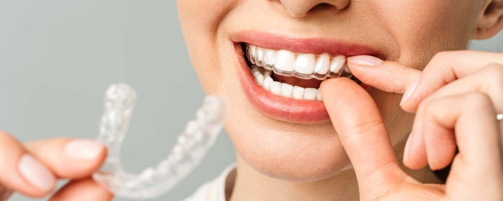Invisaling - Clínica Vivaz